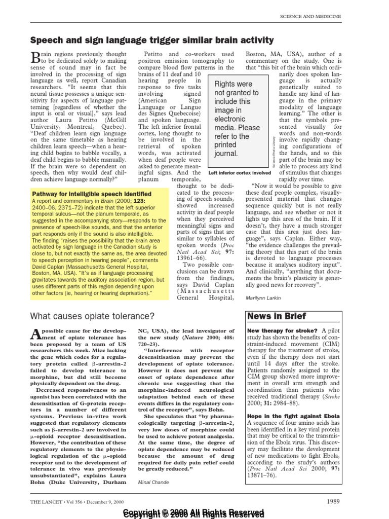 Speech and Sign Language Trigger Similar Brain Activity - DocShare.tips