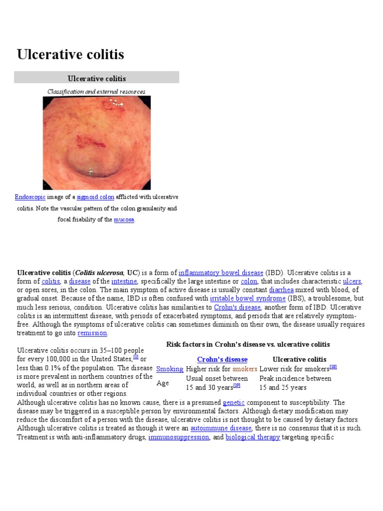 Ulcerative Colitis - DocShare.tips
